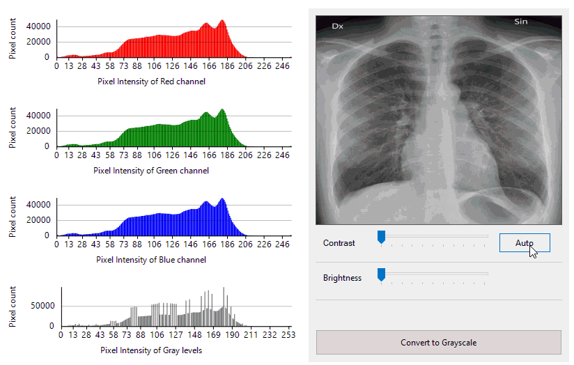 How to visualize data distribution with histogram and ranged histogram ...